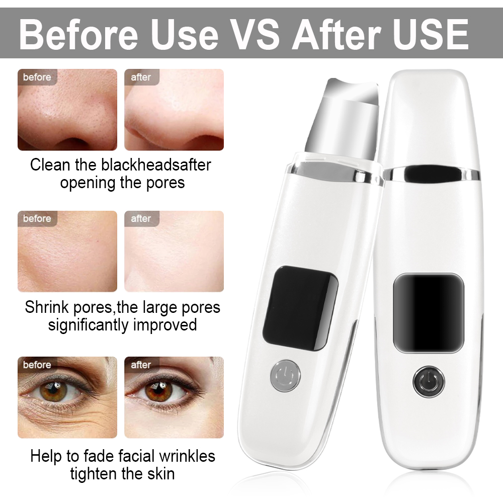 RUBYONLY Ultrasonic Skin Scrubber Vibration Face S... – Grandado