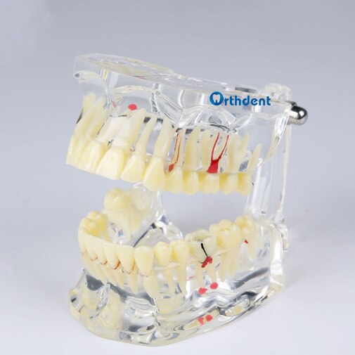 Dental Demonstration teeth Model - Standard Study ... – Grandado
