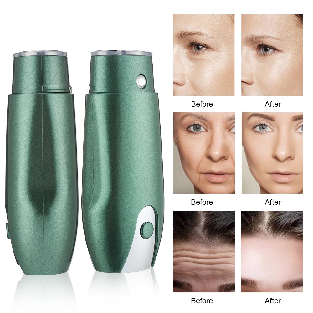 HiFu Ultrasonic EMS Skin Lifting Device V-line Sli... – Grandado