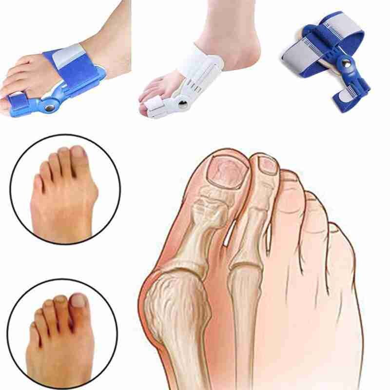 1pc Hallux Valgus grande hueso del dedo del pie ju... – Grandado
