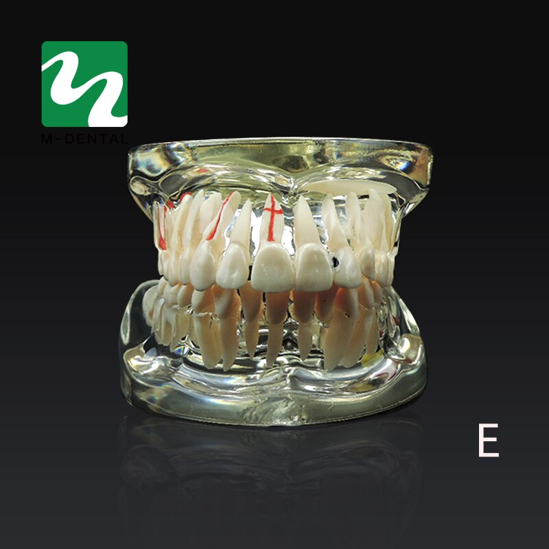 Various Dental Teeth Models Are Used For Teaching ... – Grandado