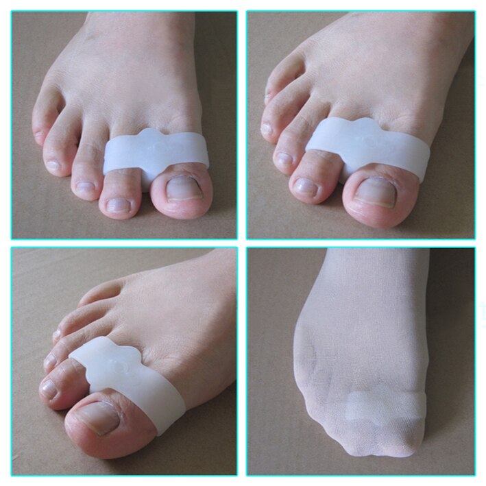2PCS Silicone Big and Second Toes Separator Hallux... – Grandado