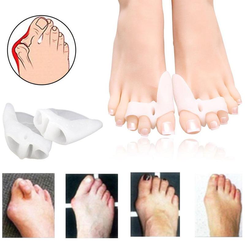 1 Pairs Hallux Valgus Braces Toes Correction Broad... – Grandado