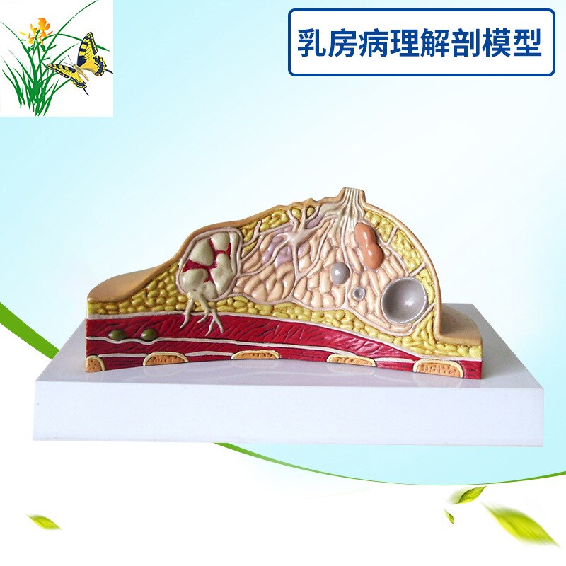 Borstkanker Borst Anatomie Model Menselijk Lichaam... – Grandado