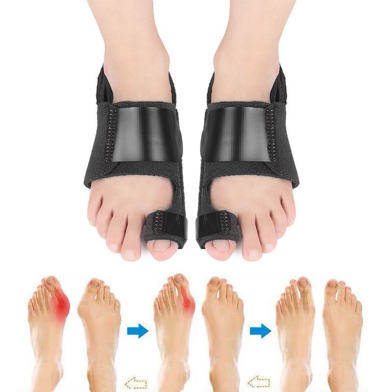 Big toe correction belt toe valgus toe divider ove... – Grandado