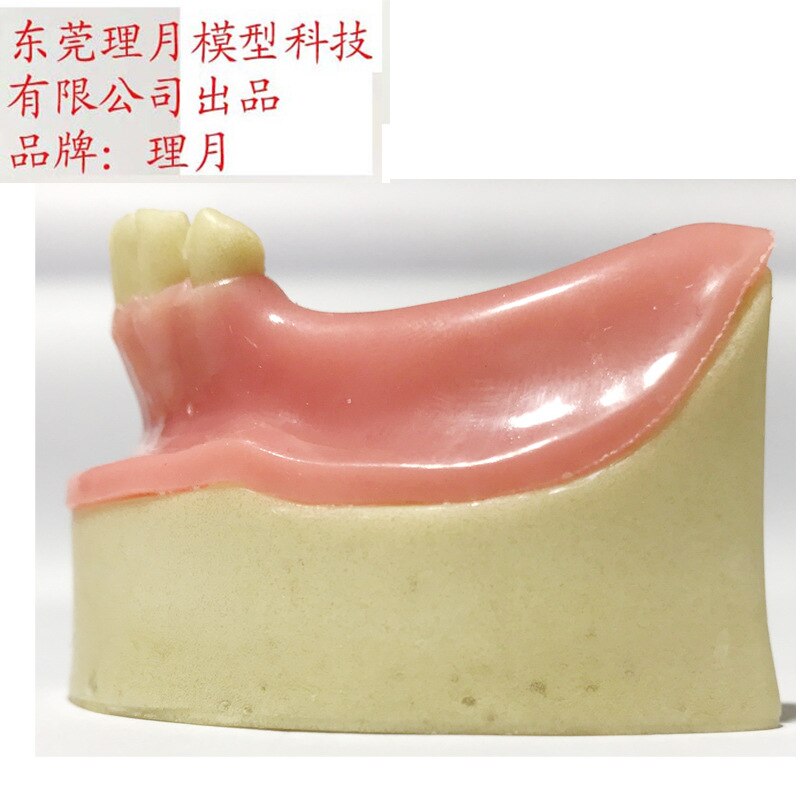 7 type Dental implant practice model Teaching and ... – Grandado