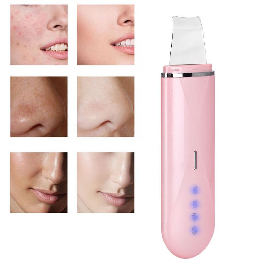 Ultrasonic Skin Scrubber Deep Face Pore Cleaning B... – Vicedeal