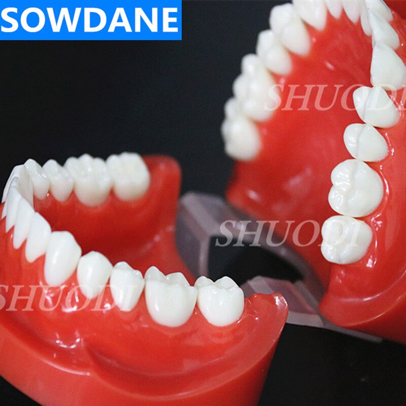 1:1 Dental Orthodontische Model Standaard Volwasse... – Grandado
