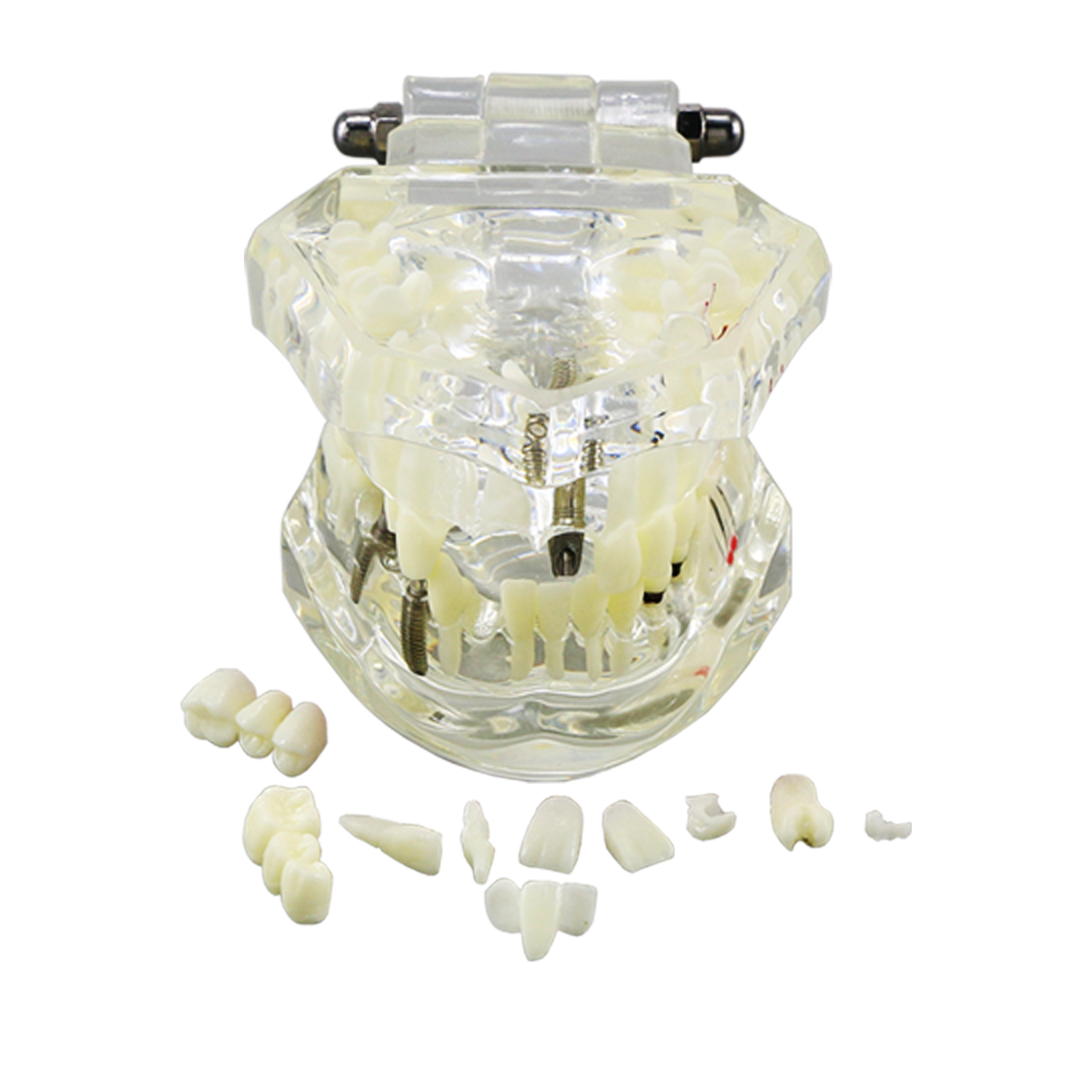 Dental Implant Restoration Typodont Teeth Tooth Mo... – Grandado