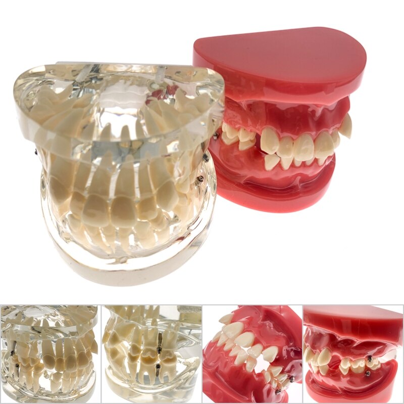 Dentist Orthodontic Tooth Model Demonstration Teac... – Grandado