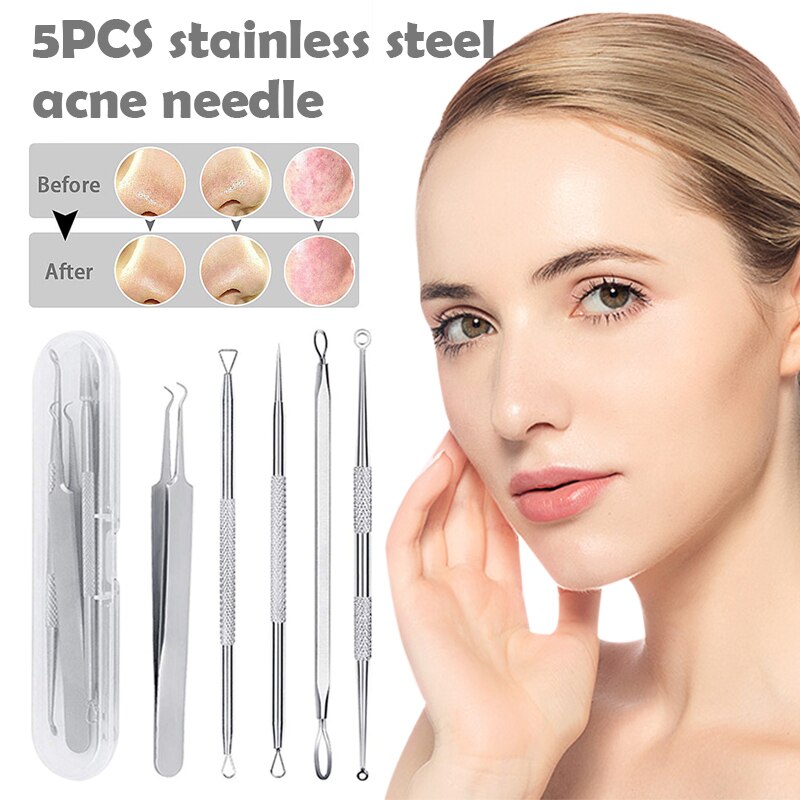 5 Piece Tool Set for Blackhead Remover Acne Extrac... – Vicedeal