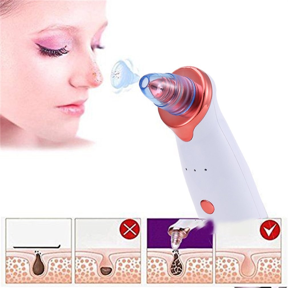 Comedo Blackhead Vacuum Suction Diamond Dermabrasi... – Vicedeal