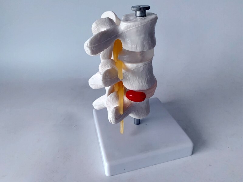 1:1 Drie-Sectie Lendenwervel Met Tussenwervelschij... – Vicedeal