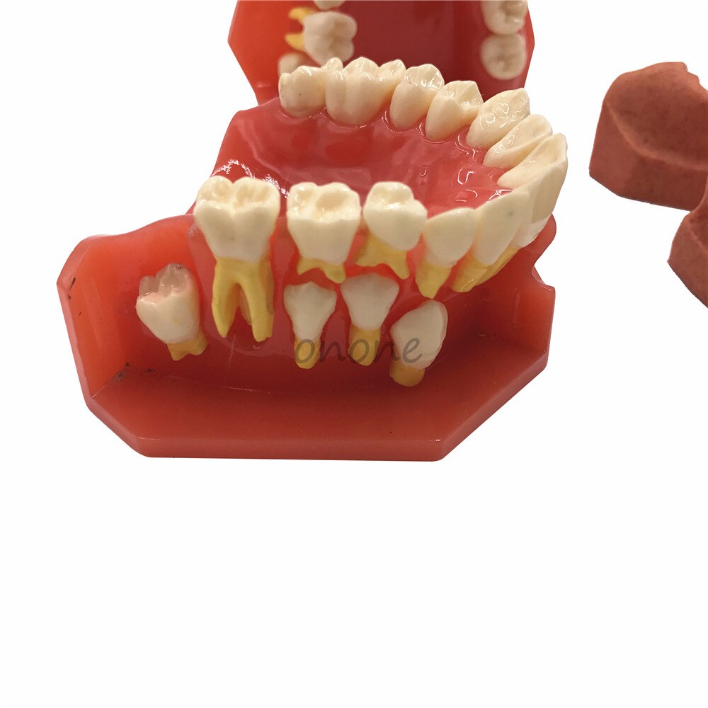 1pcs Dental Tooth Teeth Anatomical Anatomy Model C... – Grandado