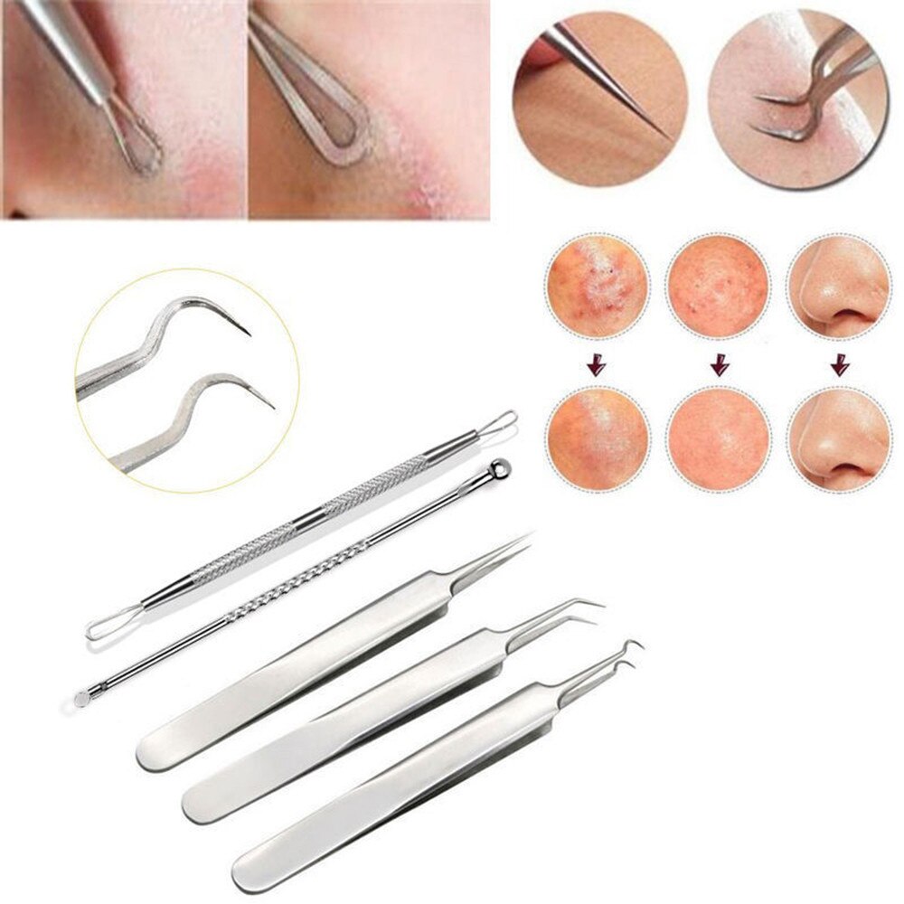 5Pcs Stainless Facial Acne Spot Pimple Remover Ext... – Grandado