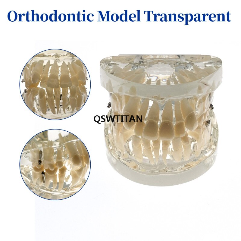Orthodontic Tooth Model Demonstration Teaching Doc... – Vicedeal