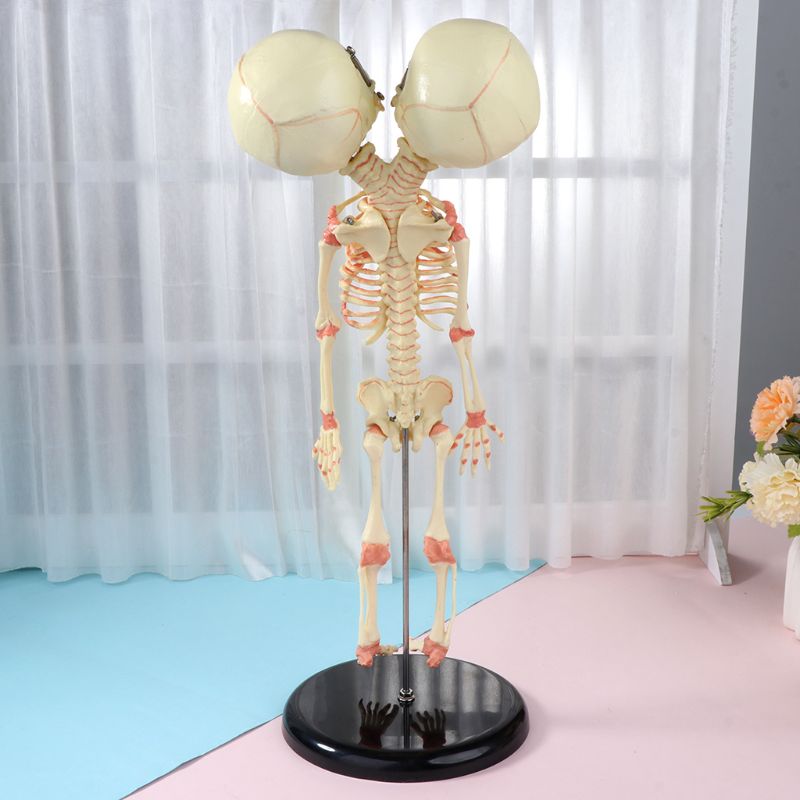 37cm Human Double Head Baby Skull Skeleton Anatomy... – Vicedeal