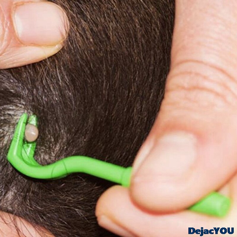 3pcs Pet Hard Tick Extractor For Removing Lice And... – Vicedeal