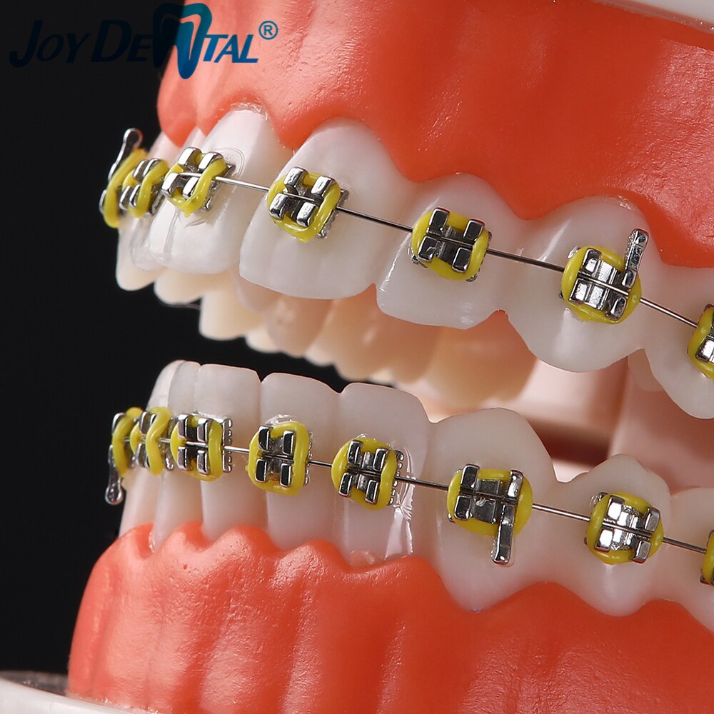 Dental Orthodontic Teeth Model with Metal Brackets... – Grandado