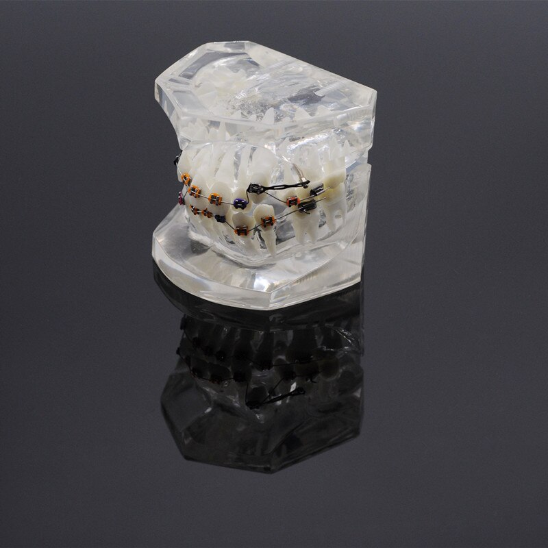 Dental Tooth Orthodontic Model Malocclusion Scienc... – Grandado