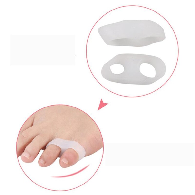 Little Finger Valgus Toe Separator Toe Bracelet Sm... – Grandado