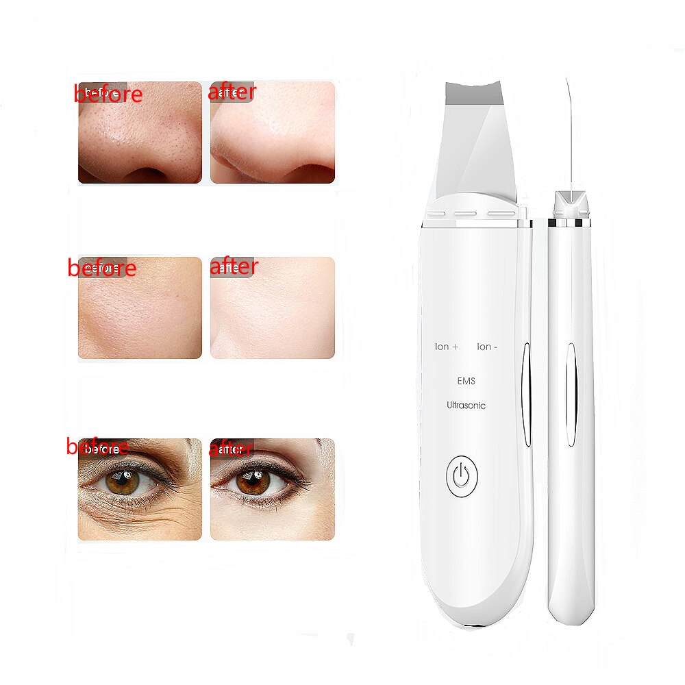 Ultrasonic Skin Scrubber Deep Face Cleaning Machin... – Grandado