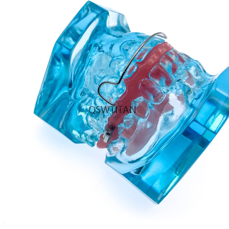 Dental Functional Orthopedic Bionator Removable Mo... – Vicedeal