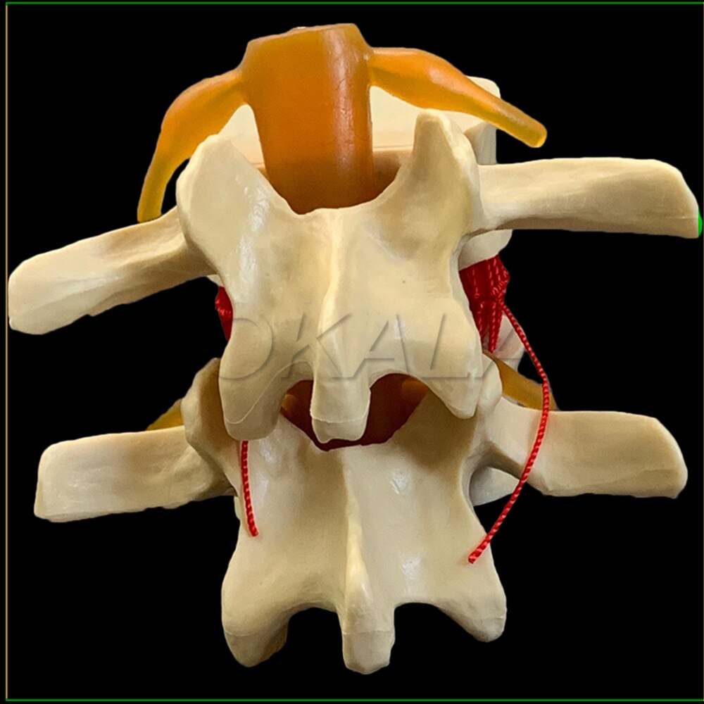 Good 1pcs Human lumbar disc herniation model demon... – Grandado