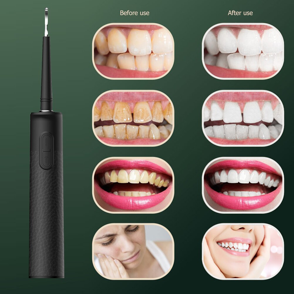 3 in 1 Electric Ultrasonic Sonic Dental Scaler Too... – Grandado