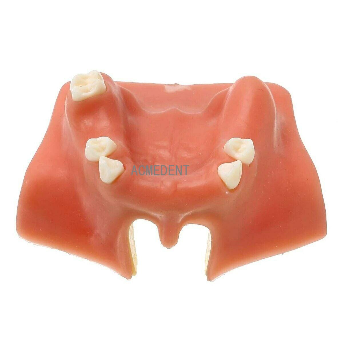1PCS Dental Model Lift Practice Teaching Teeth Mod... – Grandado
