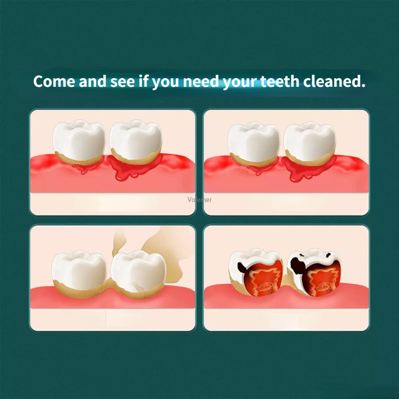 Xiaomi Youpin T-FLASH Ultrasonic Scaler J1 Househo... – Grandado