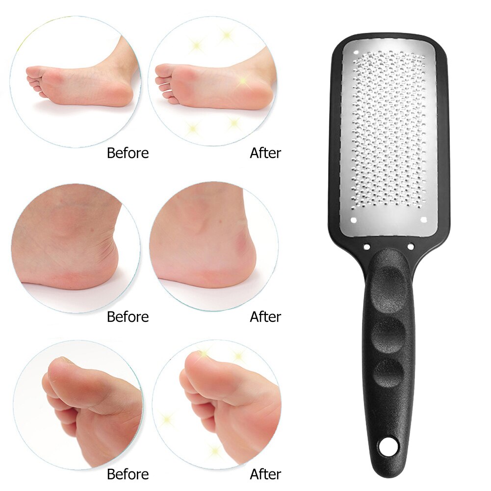 Pro Voet Bestand Rasp Eelt/Dikke Hard Skin Eelt Sc... – Grandado