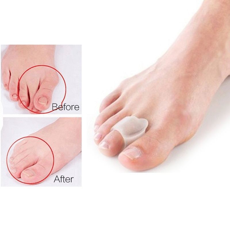 1 Pair Bone Thumb Toe Separators Health Care Hallu... – Grandado
