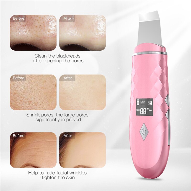 Ultrasonic Skin Scrubber Warmer Facial Cleanser Di... – Vicedeal