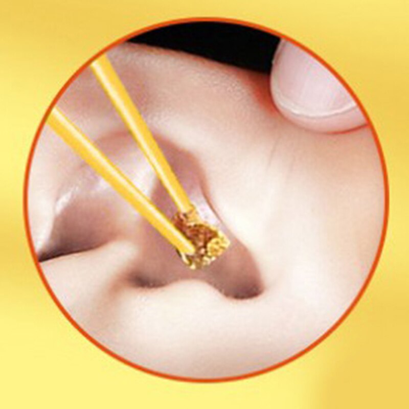 Yellow Ear Cleaner Earpick Easy Ear Wax Remover Sp... – Grandado