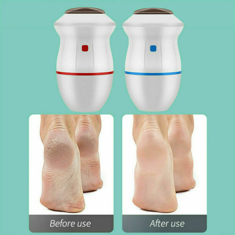 Electric Pedicure Foot Grinding Skin Hard Rupture ... – Vicedeal