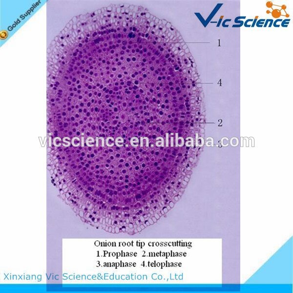 5pcs/set plant mitosis slides set of onion root ti... – Vicedeal