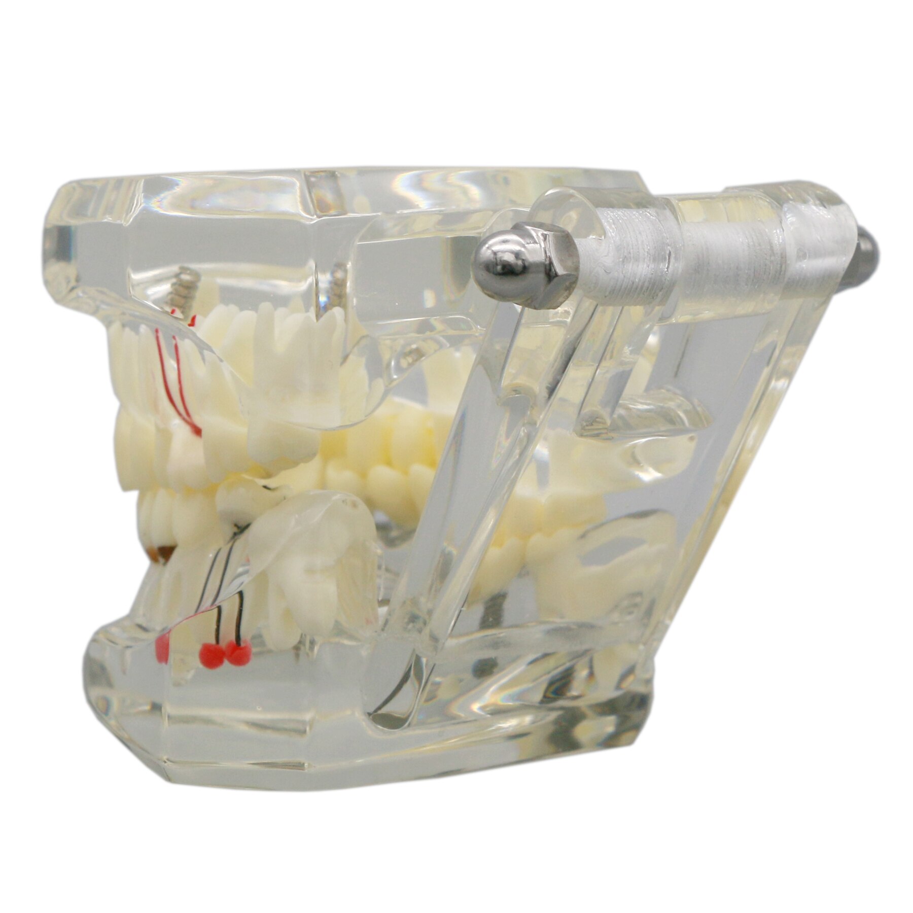 Dental Implant Restauratie Typodont Tanden Model D... – LovingPrices