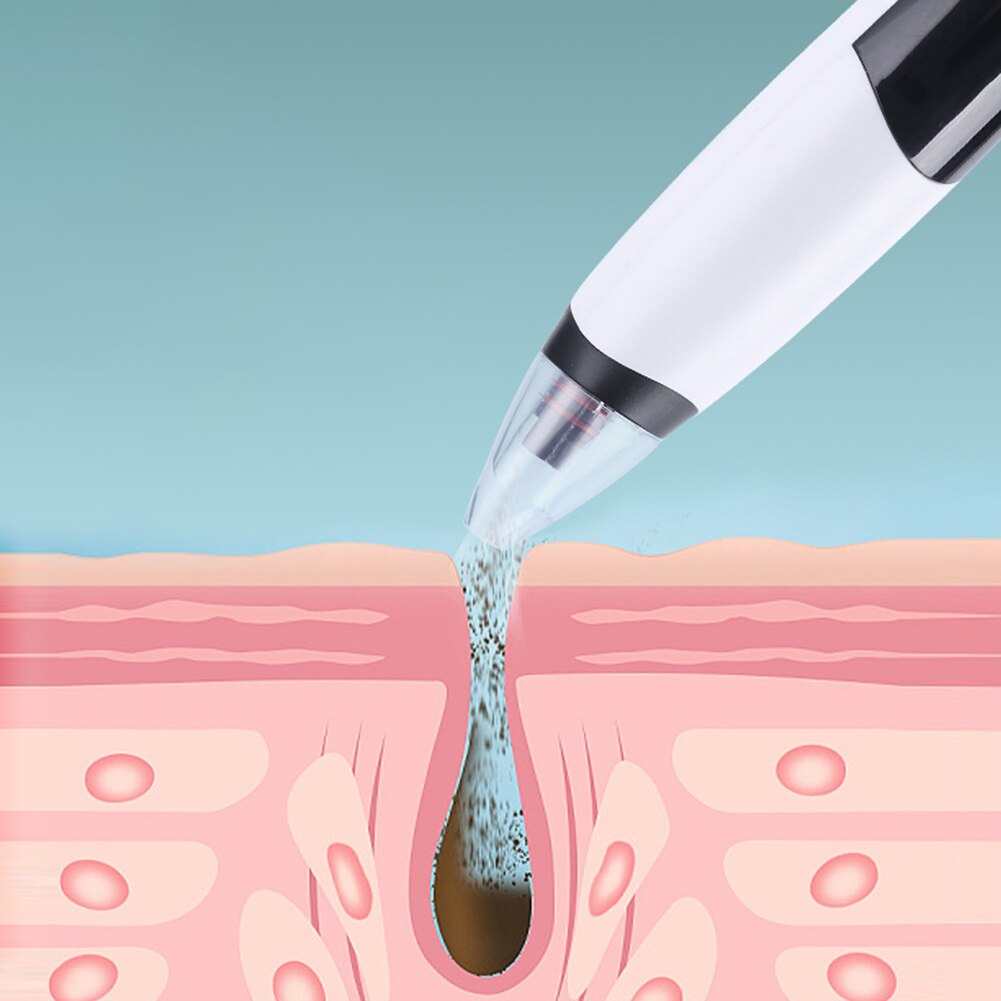 Electric Blackhead Acne Remover Device Pro Safety ... – Grandado