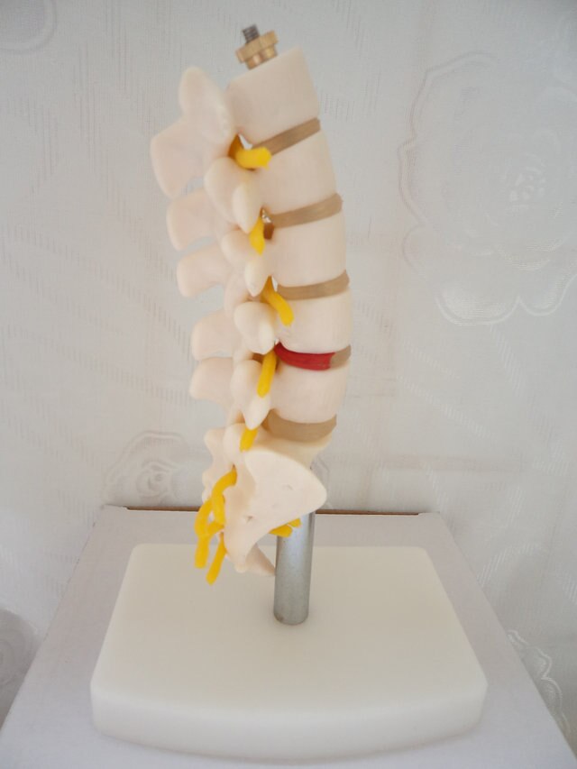 15CM Height Human Lumbar Model Spine Small Five Lu... – Vicedeal