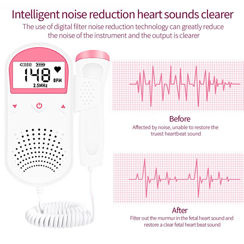 Baby Monitor Fetal Doppler Ultrasound Fetus Dopple... – Grandado
