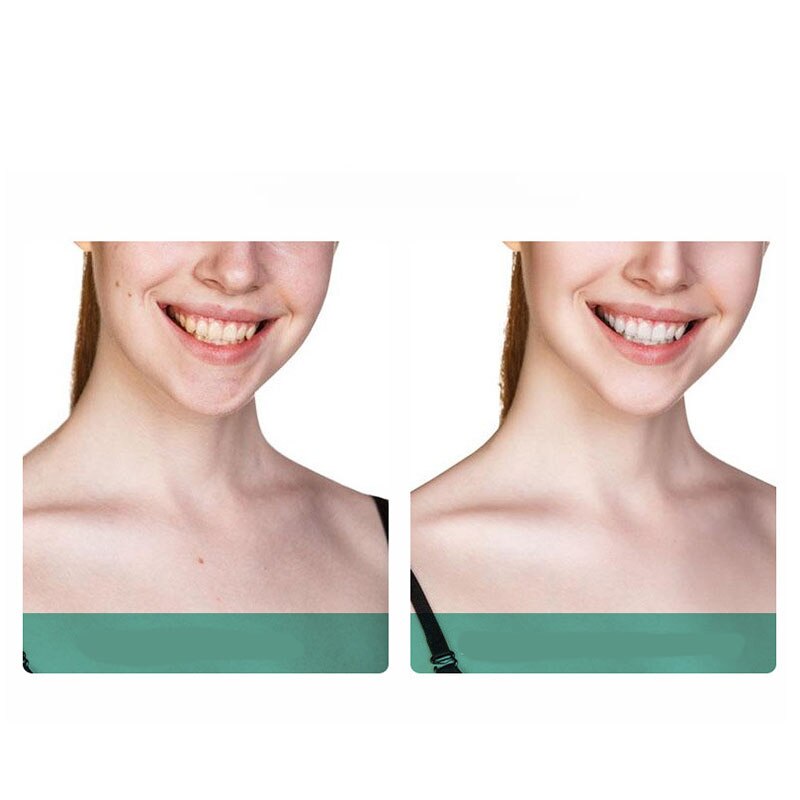 Face Massager Lifting Visage Neck Anti Wrinkle Dou... – Vicedeal