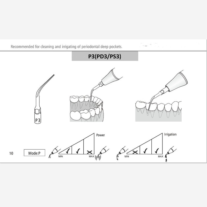 5pcs PD3 dental scaler tips dental equipment teeth... – Grandado