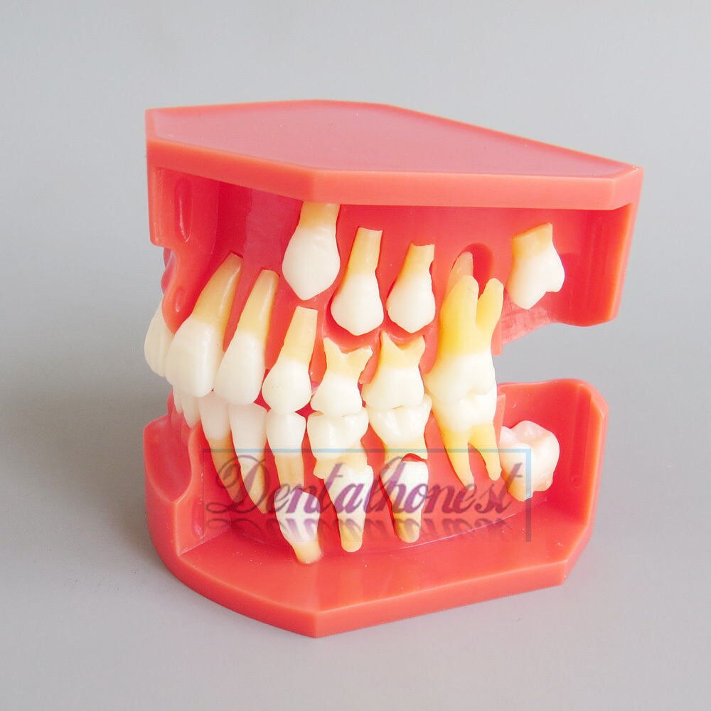 Dental Model #4006 01 - Teeth Eruption Development... – Vicedeal