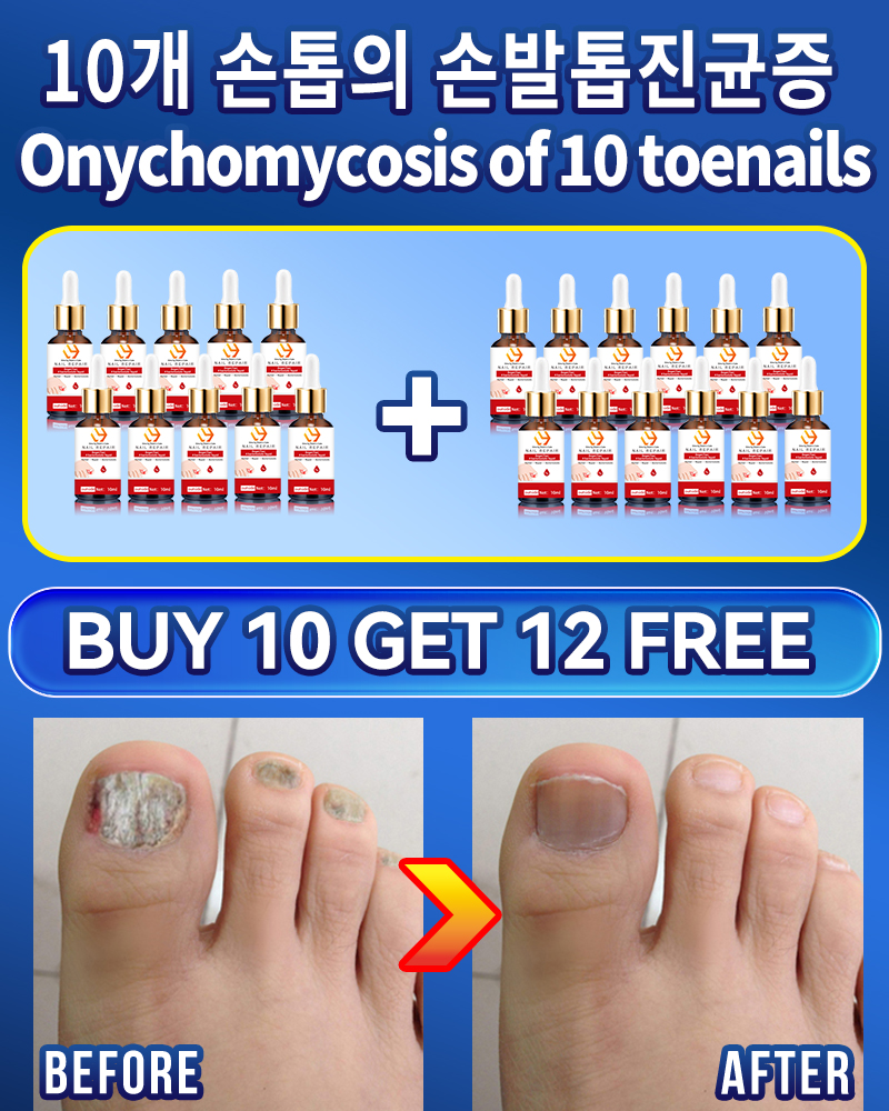 Solves all nail problems – Vicedeal