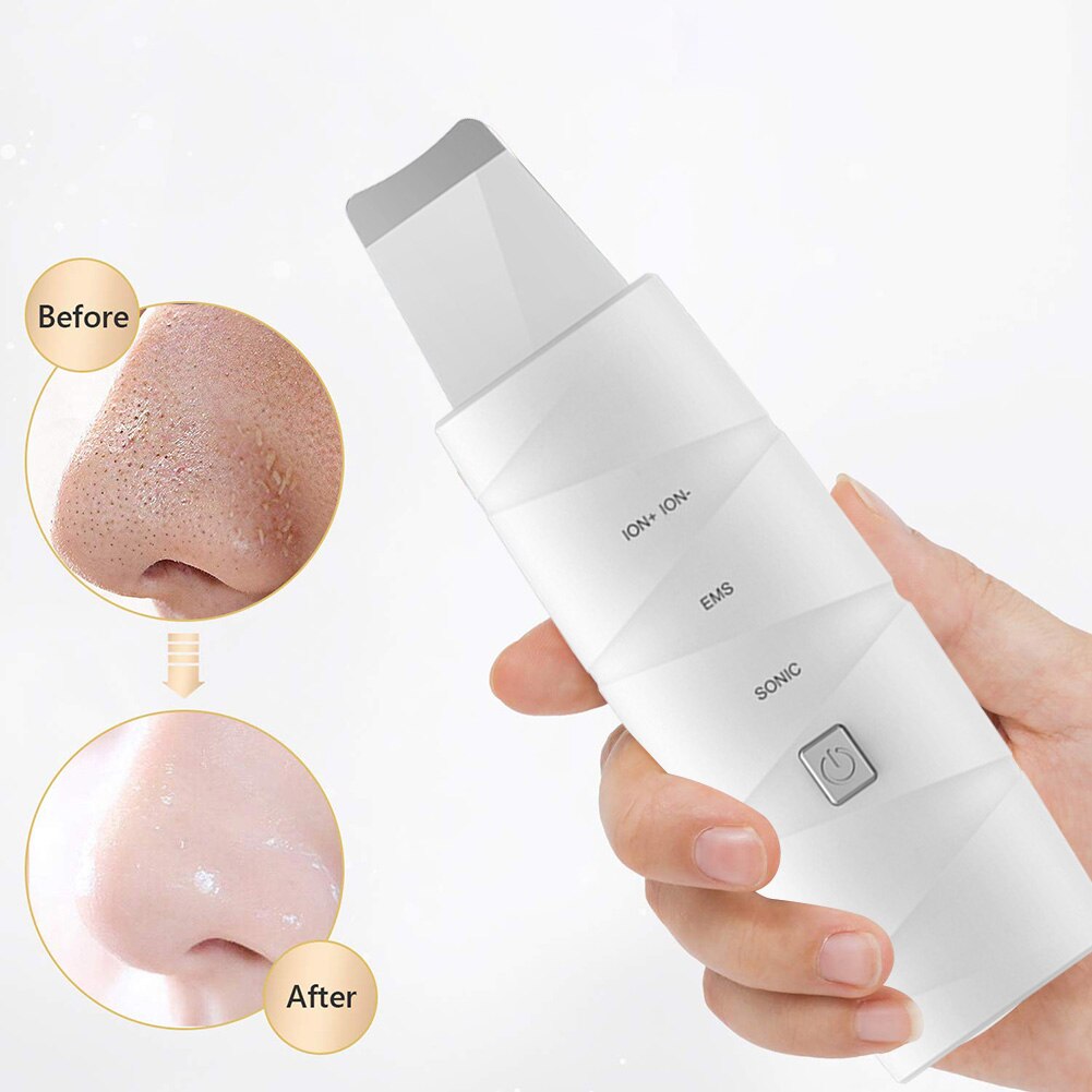 Ultrasonic Peeling Scrubber Machine Vibration Blac... – Vicedeal