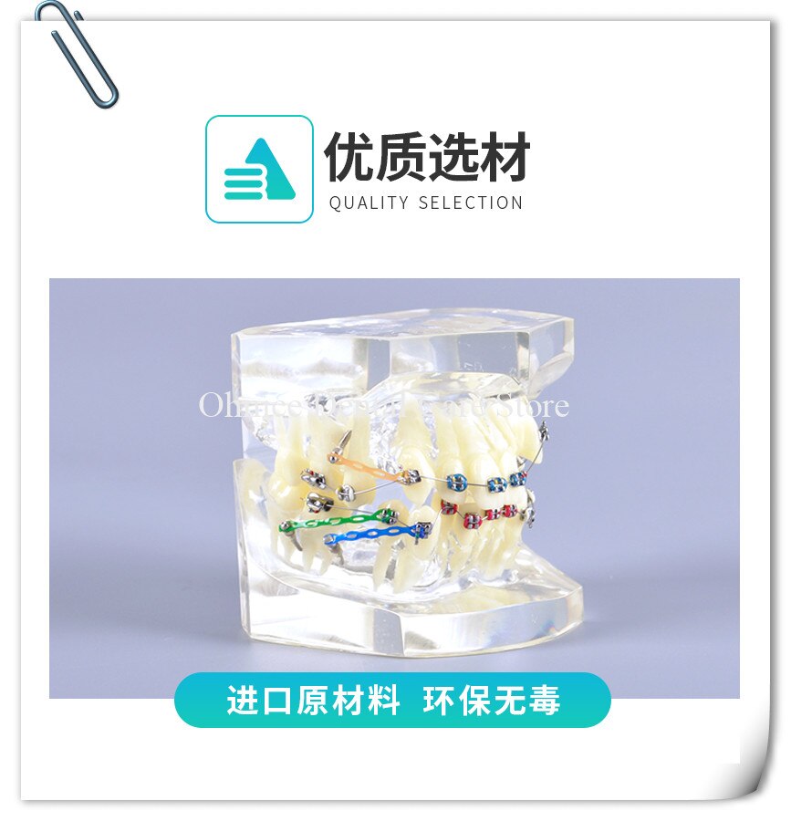 Orthodontic study teeth model M3005 with buccal tu... – Vicedeal