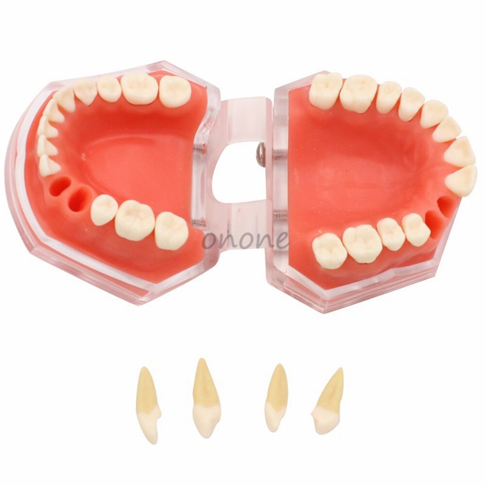 Dental Standard Model with Removable Teeth Dental ... – Vicedeal