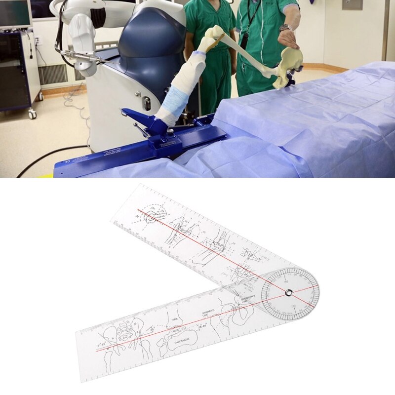 Goniometer Angle Ruler Rule Joint Orthopedics Tool... – Grandado