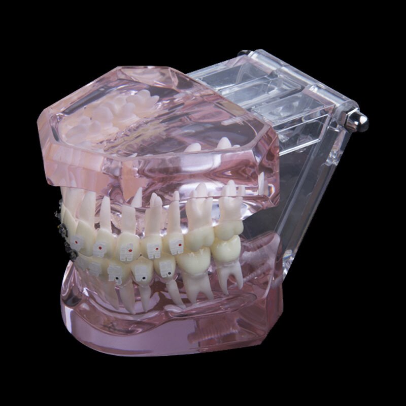 Dentist tooth human anatomy model classic repairab... – Vicedeal